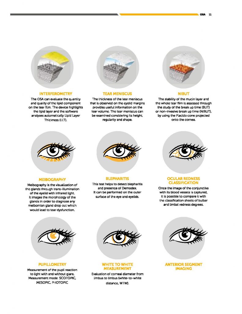 Ocular Surface Analyzer – Innovation in Ophthalmology